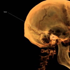 A Beginners Guide to Lateral Cephalometric Radiographs